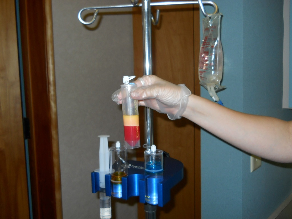 AUTOLOGOUS BONE MARROW ASPIRATE CONCENTRATE (BMAC) - The Orthobiologic ...